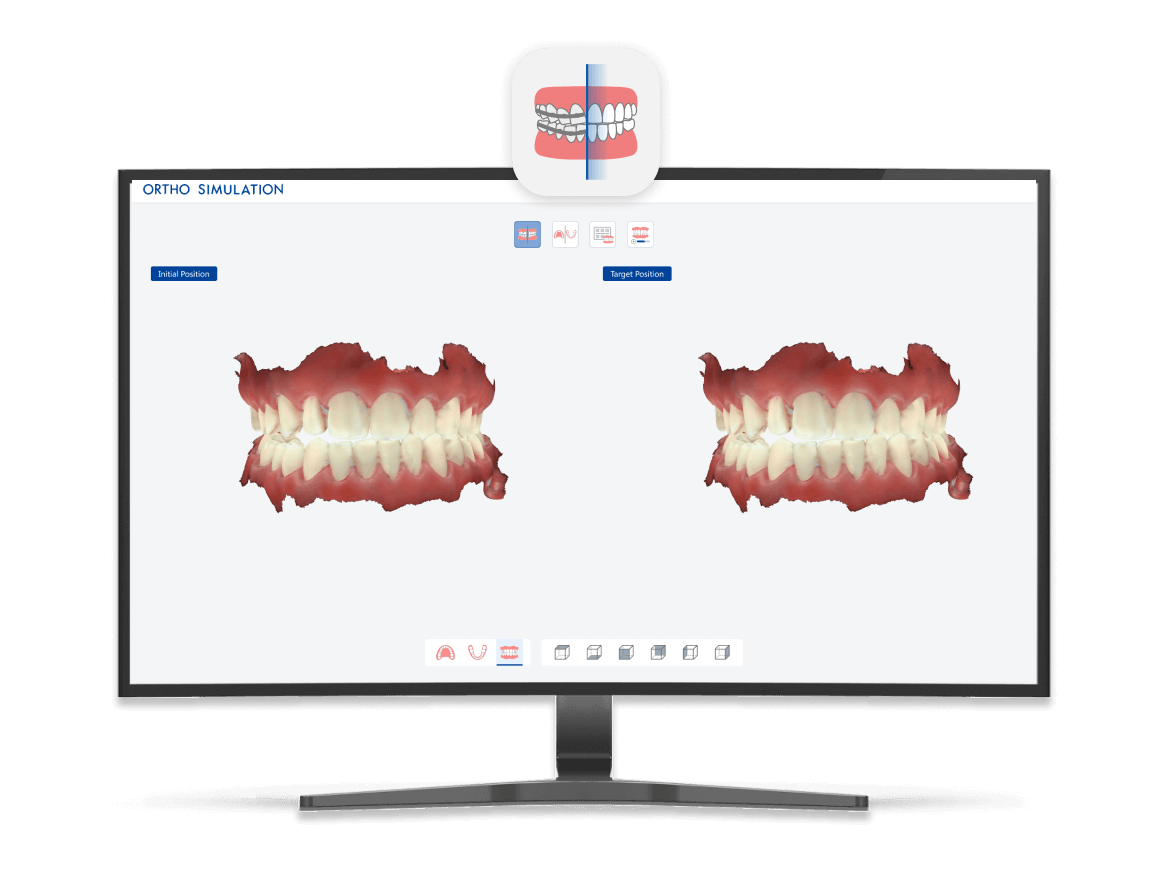 Ortho Simulation
