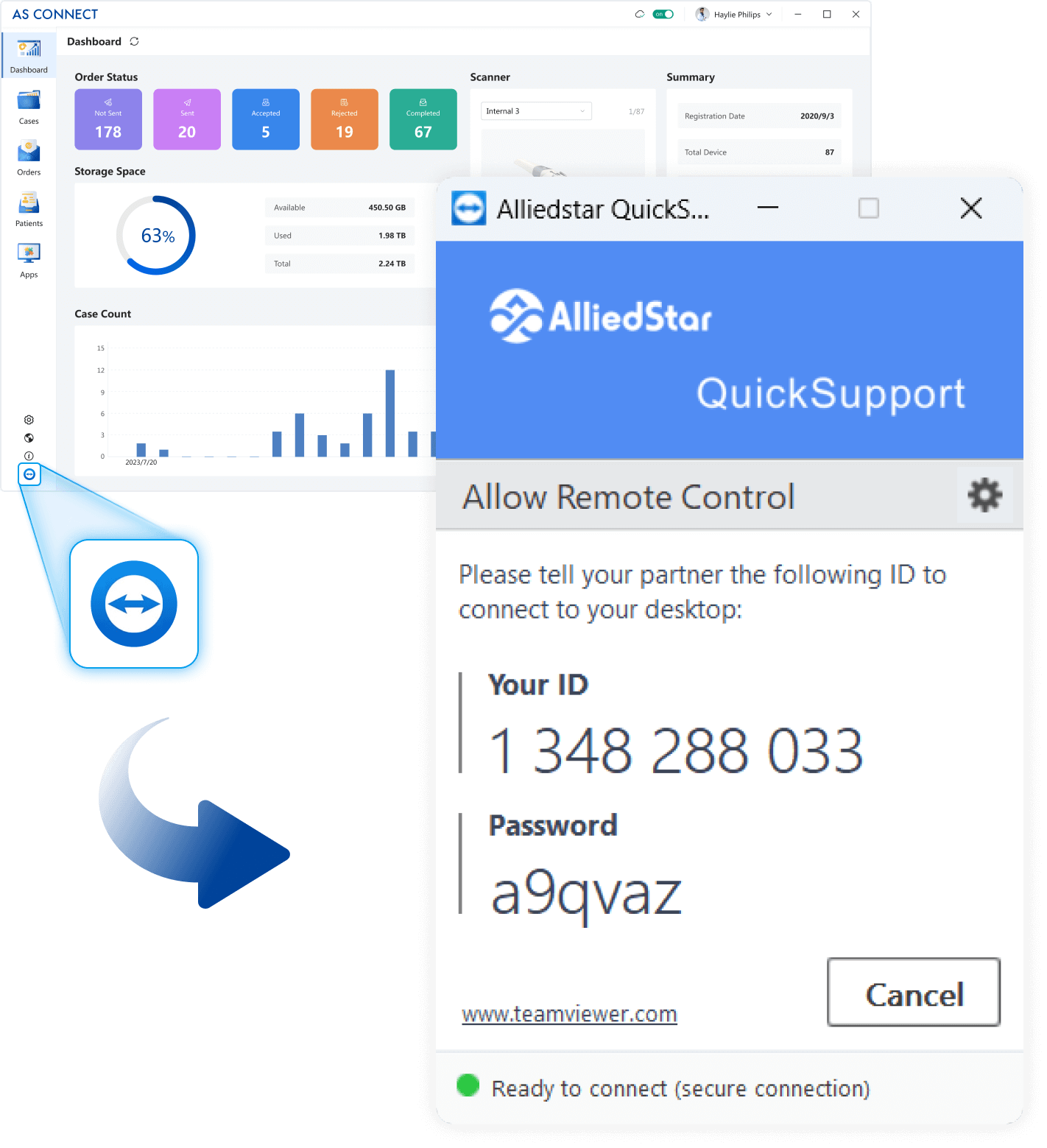 Exocad workflow integration