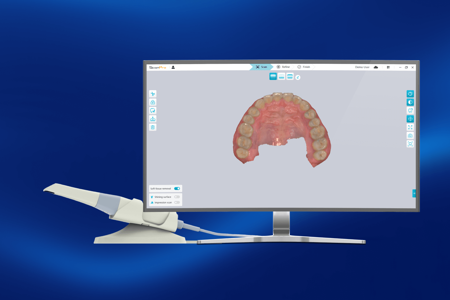 ScanPro 1.0.28 Software Update